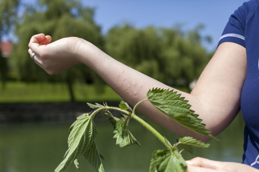 Stinging Nettle Remedies for Hayfever and Inflammation